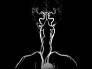 MRI - Zwanger-Pesiri Radiology